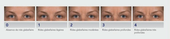 TRAITER LA RIDE DU LION ( OU DE LA GLABELLE )