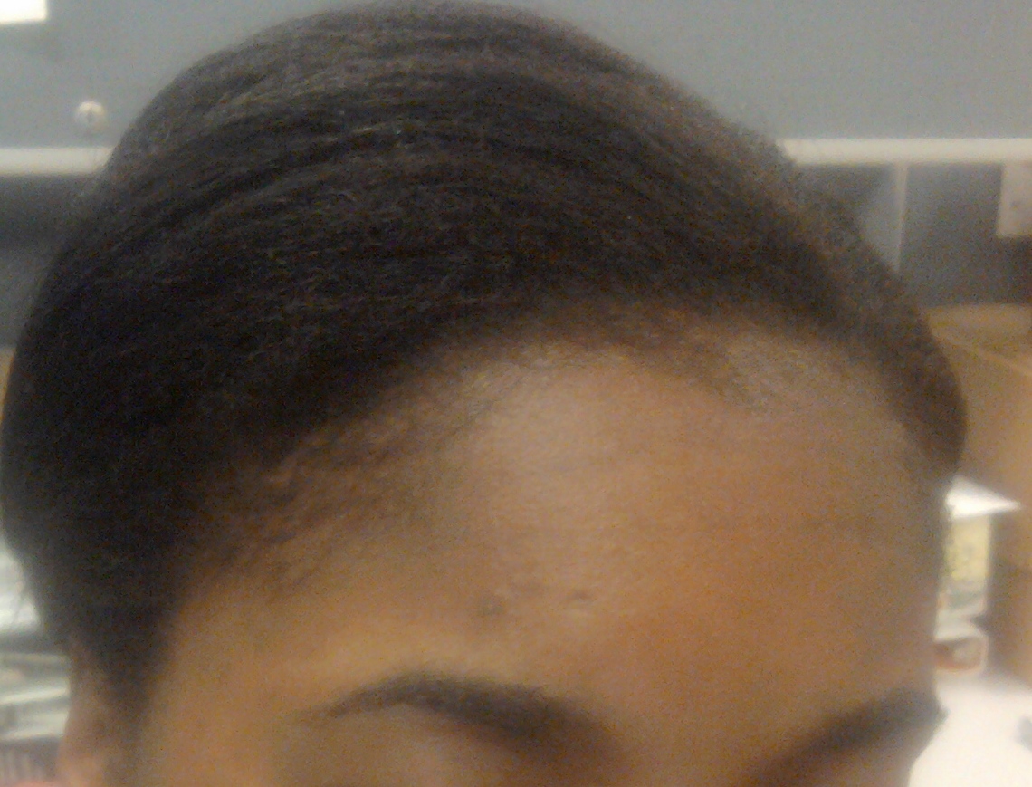 6FOOTLONGHAIR: My Poor Edges!