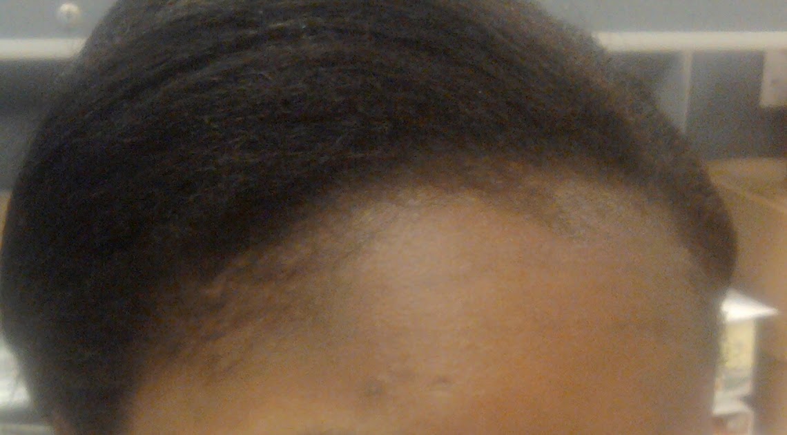 6FOOTLONGHAIR: My Poor Edges!