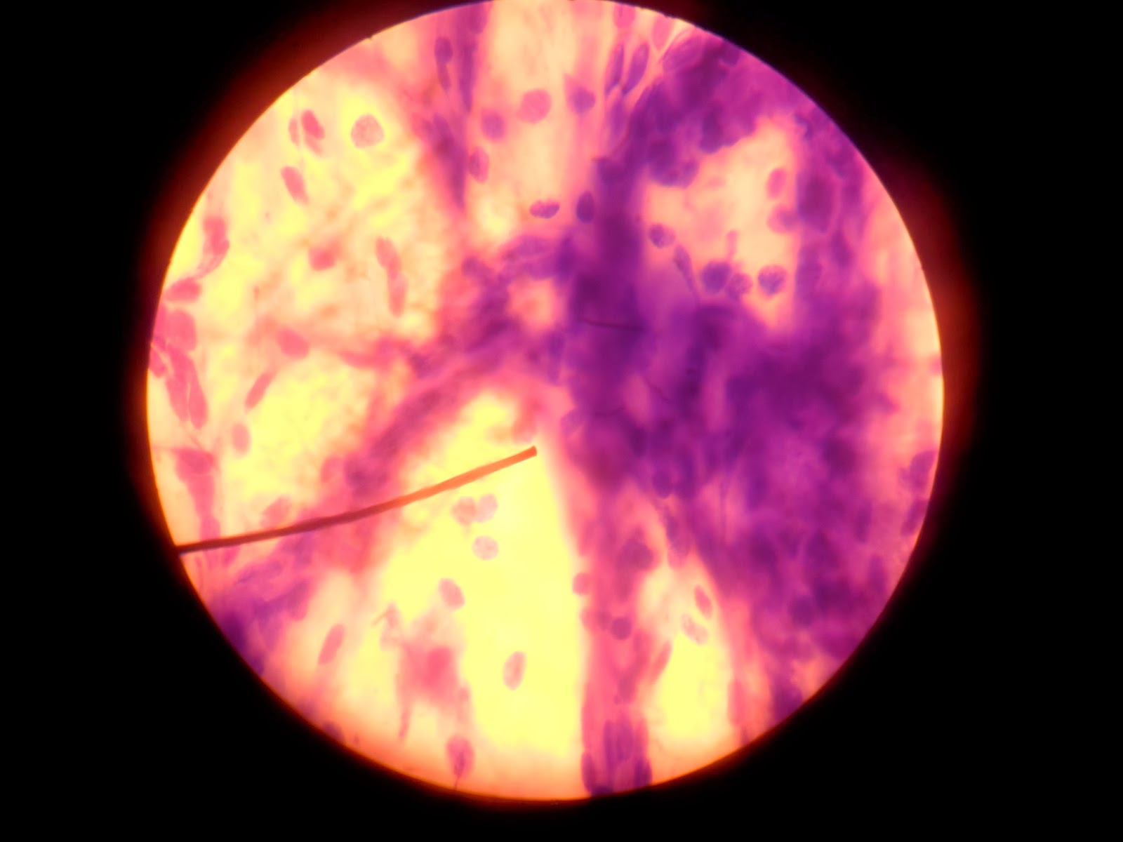 Ourlad's Paradigm: Nervous Tissue