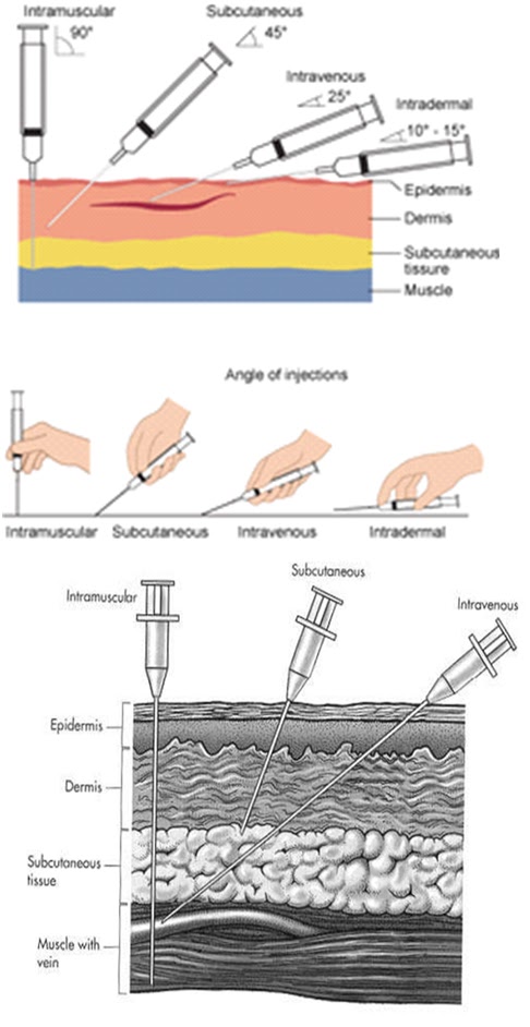 Medicinal Chemistry Basics (All you need to know): Routes of drug ...