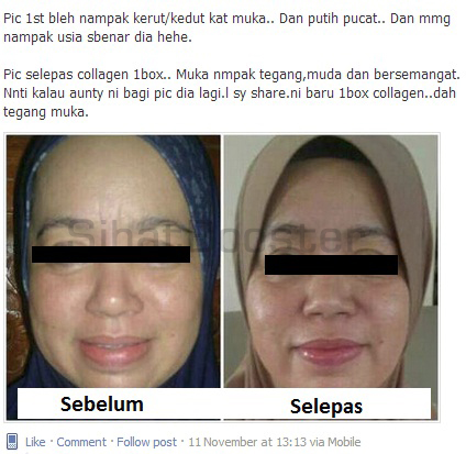 Sihat Booster: SHAKLEE EFFECT : Testimoni pengguna Shaklee Collagen ...