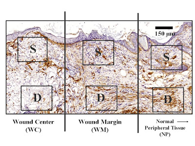 My unpublished biomedical research: Wound Healing and ...