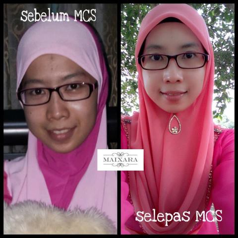 ORKID BIRU BEAUTY CENTRE: MAIXARA C-SENTIAL: VITAMIN C PLUS KOLAGEN DAN ...