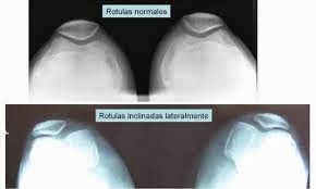 Valoración del movimiento y prescripción de ejercicio: LA SENTADILLA ...