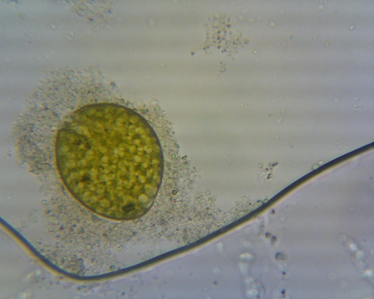 KEHIDUPAN DALAM SETETES AIR (Plankton di Indonesia)