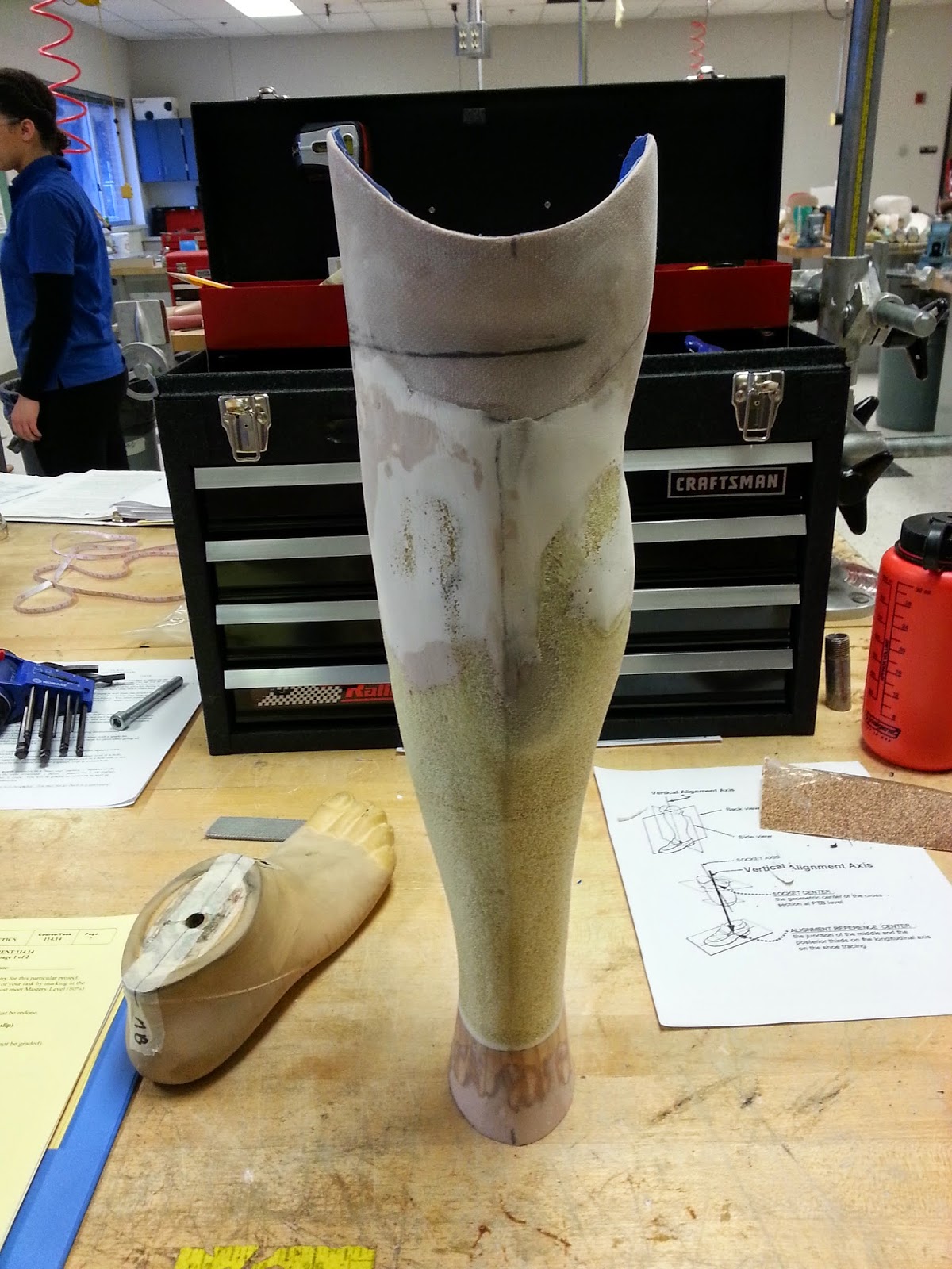 Prosthetic Projects: PTB Exoskeletal Prosthesis