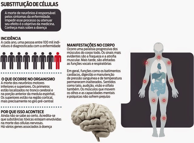 Esclerosis Lateral Amiotrófica Sintomas : Esclerosis Lateral ...