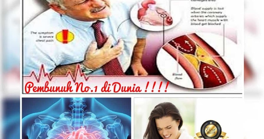 KENALI CIRI-CIRI SAKIT JANTUNG