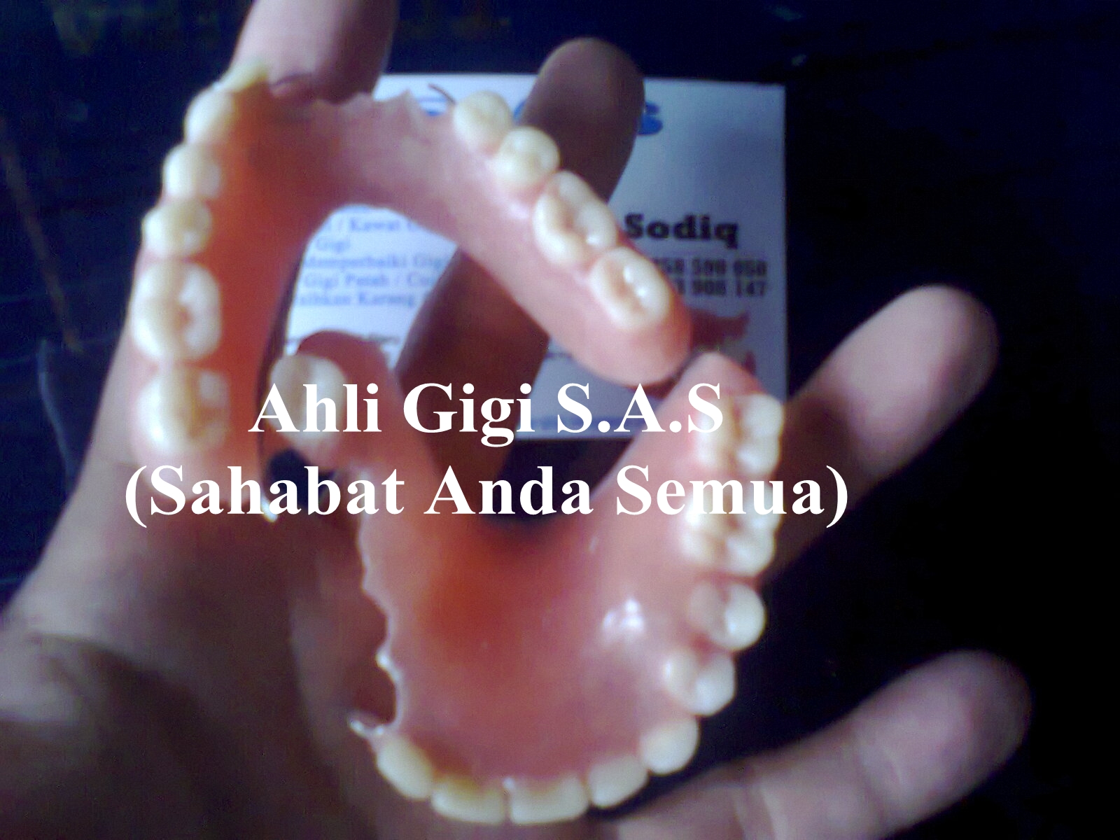S.A.S - AHLI GIGI KOTA PATI, Jateng & KOTA JEMBER, Jatim: Koleksi Foto Gigi Palsu Lepas Pasang S ...