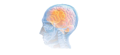 Programa FARCAVI: Campaña Ataque Cerebro Vascular - ACV