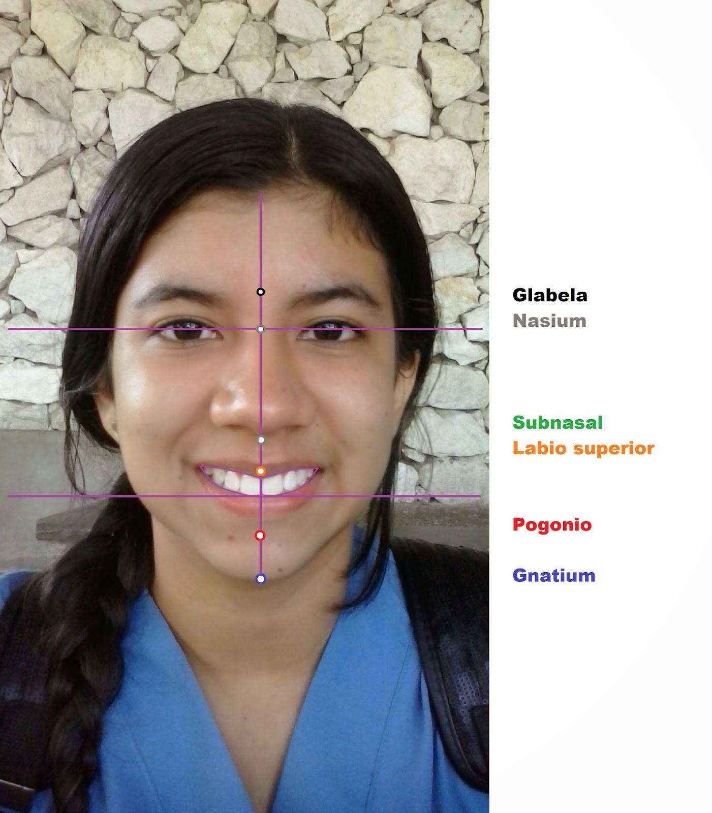 Análisis de Sonrisa : abril 2015