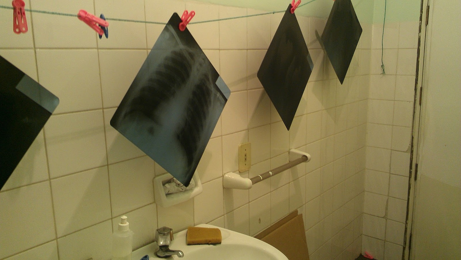 JHL: Paging Dr. Ben Casey.....