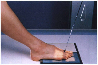 AP PROJECTION : TOES - RadTechOnDuty