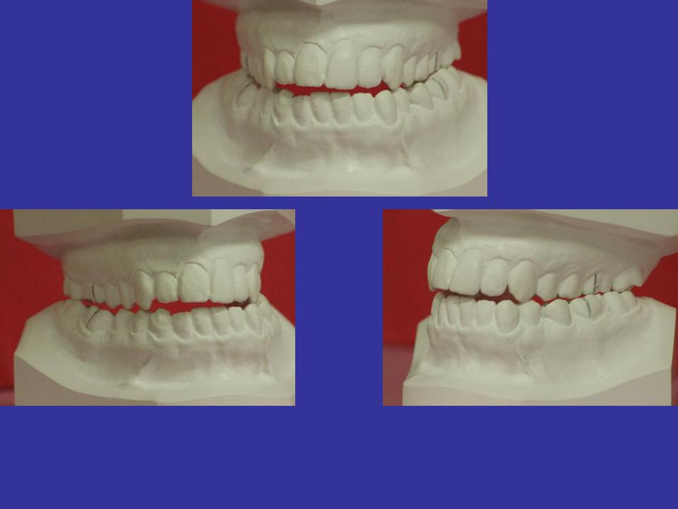 Ramin Mehregan D.M.D.: NEUROMUSCULAR APPROACH IN THE TREATMENT OF ...