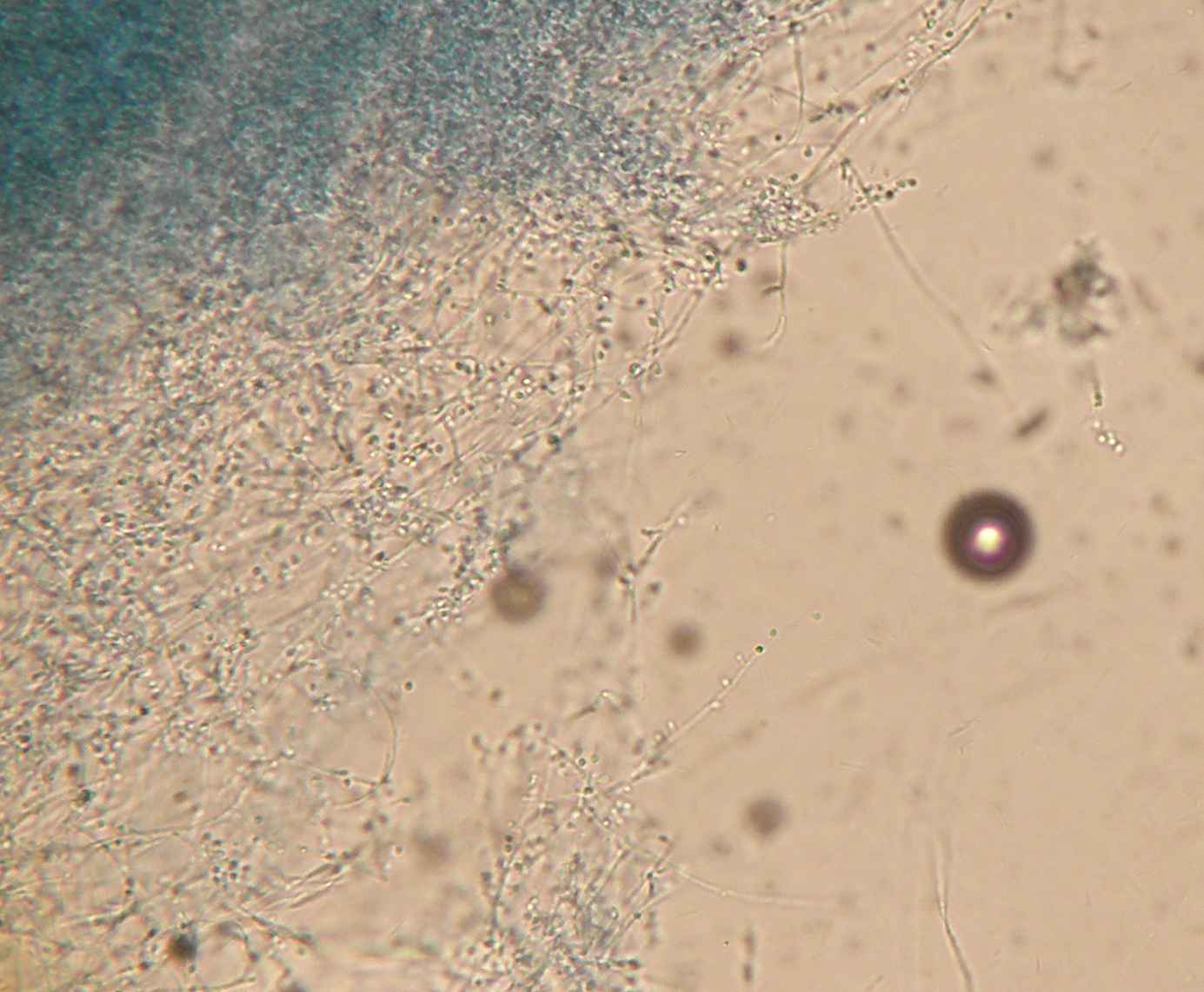 ATLAS MICOLOGIA: TRICHOPHYTON RUBRUM