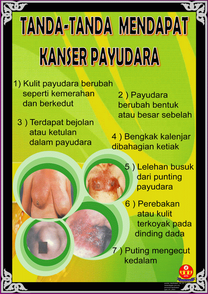 Blog Saya Sihat: Ketahui punca serangan kanser payudara