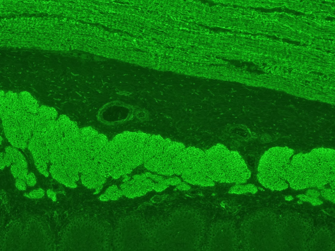 Anticorpos anti - endomísio