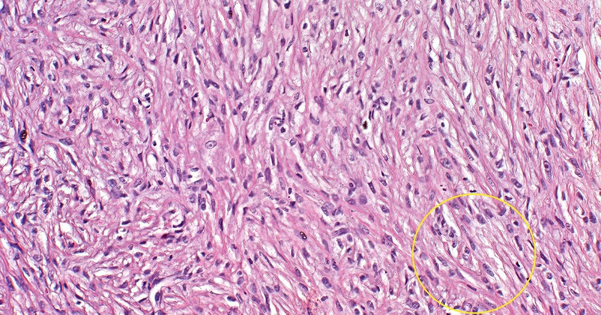 Motic Europe | Blog: Fibrosarcoma cat