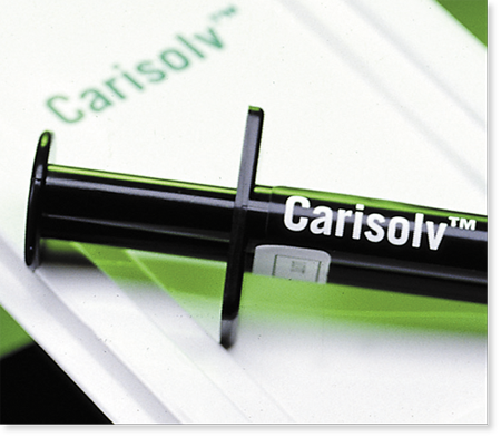 :: World Of Dentistry ::: Cariosolv - Chemo-mechanical Caries Removal
