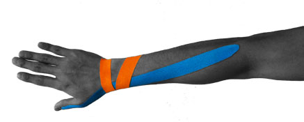 ARES Kinesiology Tape: Thumb Tendinitis