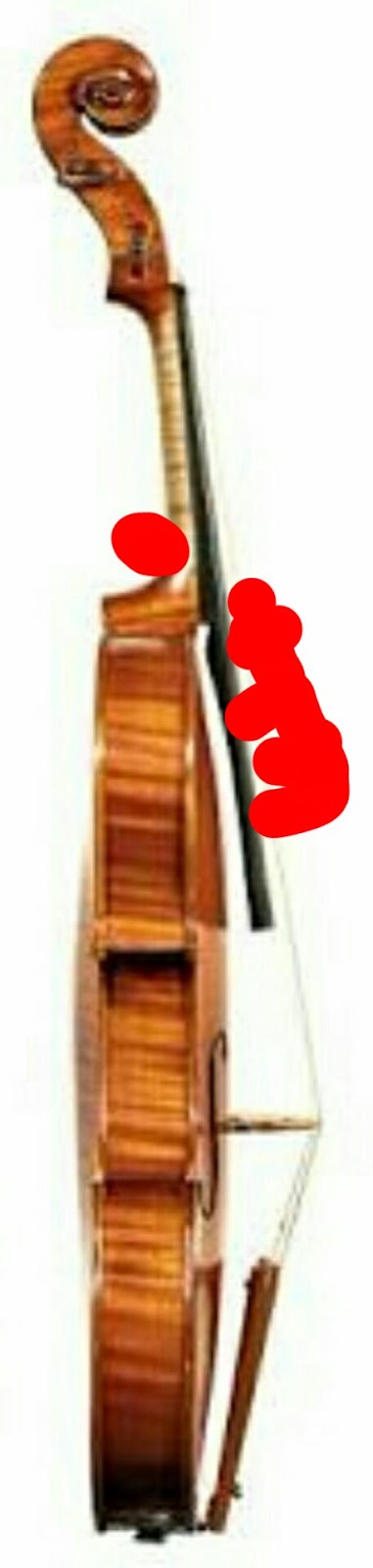 Lap Surgeon: VIOLIN PLAYING IN HIGHER POSITIONS EFFECTIVELY