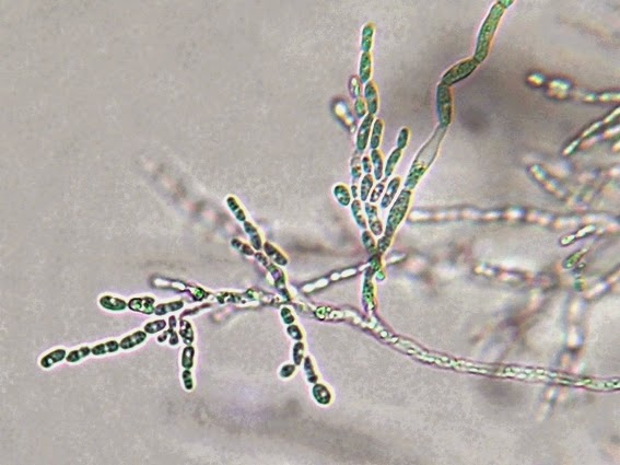 Fun With Microbiology (What's Buggin' You?): Trichosporon species