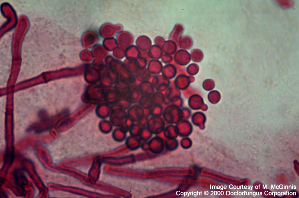 Las Dianas: Malassezia