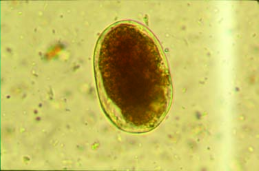 Blog del Laboratorio clinico : Necator americanus