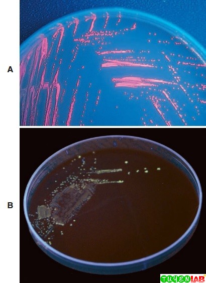 [Microbiology] Atlas of Anaerobes of Clinical Importance | Free Medical ...