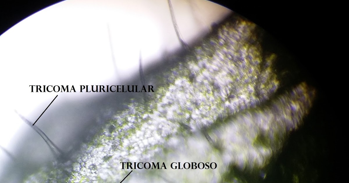 Observación de tricomas y estomas