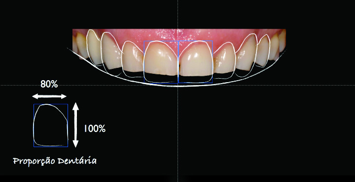 Dental smile designer software free download DSD