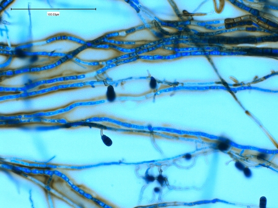 Fun With Microbiology (What's Buggin' You?): Pithomyces species