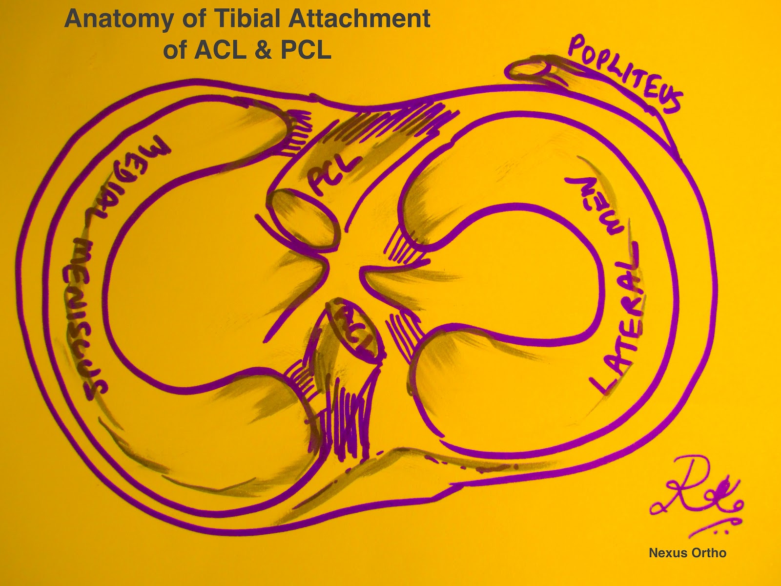 Indiaorthosurgeon: August 2012