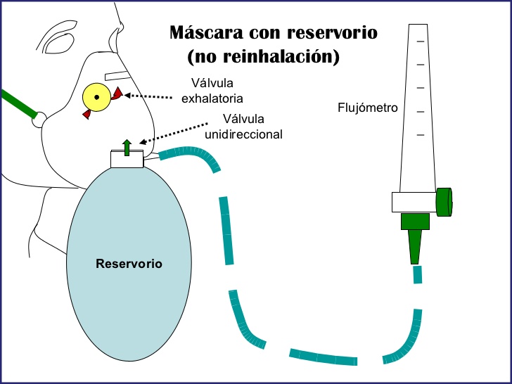 PRÁCTICAS DE ENFERMERÌA : oxigenoterapia