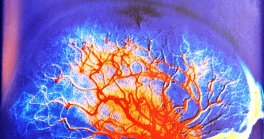 Discovering Something New -- ongoing learning: Oxygen supply to human brain