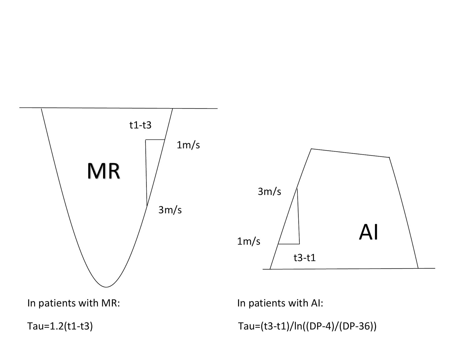 left ventricular diastolic time constant: Tau and Beyond
