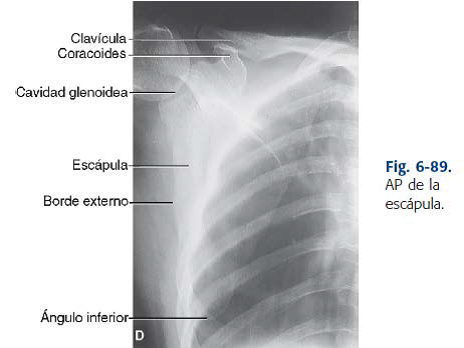 PRODUCCION Y TRATAMIENTO DE IMAGENES DIAGNOSTICAS: CAPITULO HUMERO Y ...