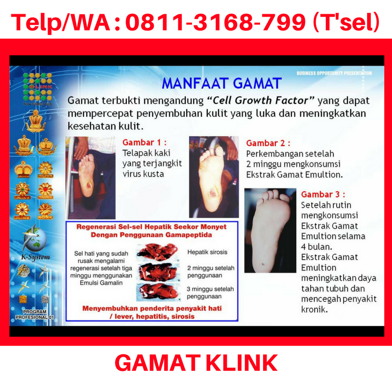 0811-3168-799 (T'Sel), K Link Gamat Gel: 0811-3168-799 (T'Sel), K Link ...