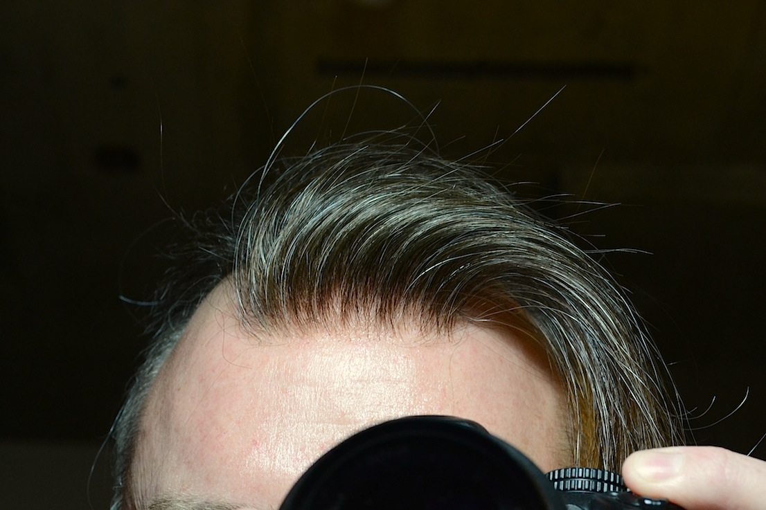 HairSay: New Hairline