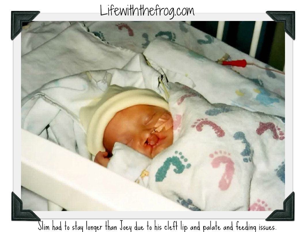 kissing the frog: A Premature Baby Story x 2