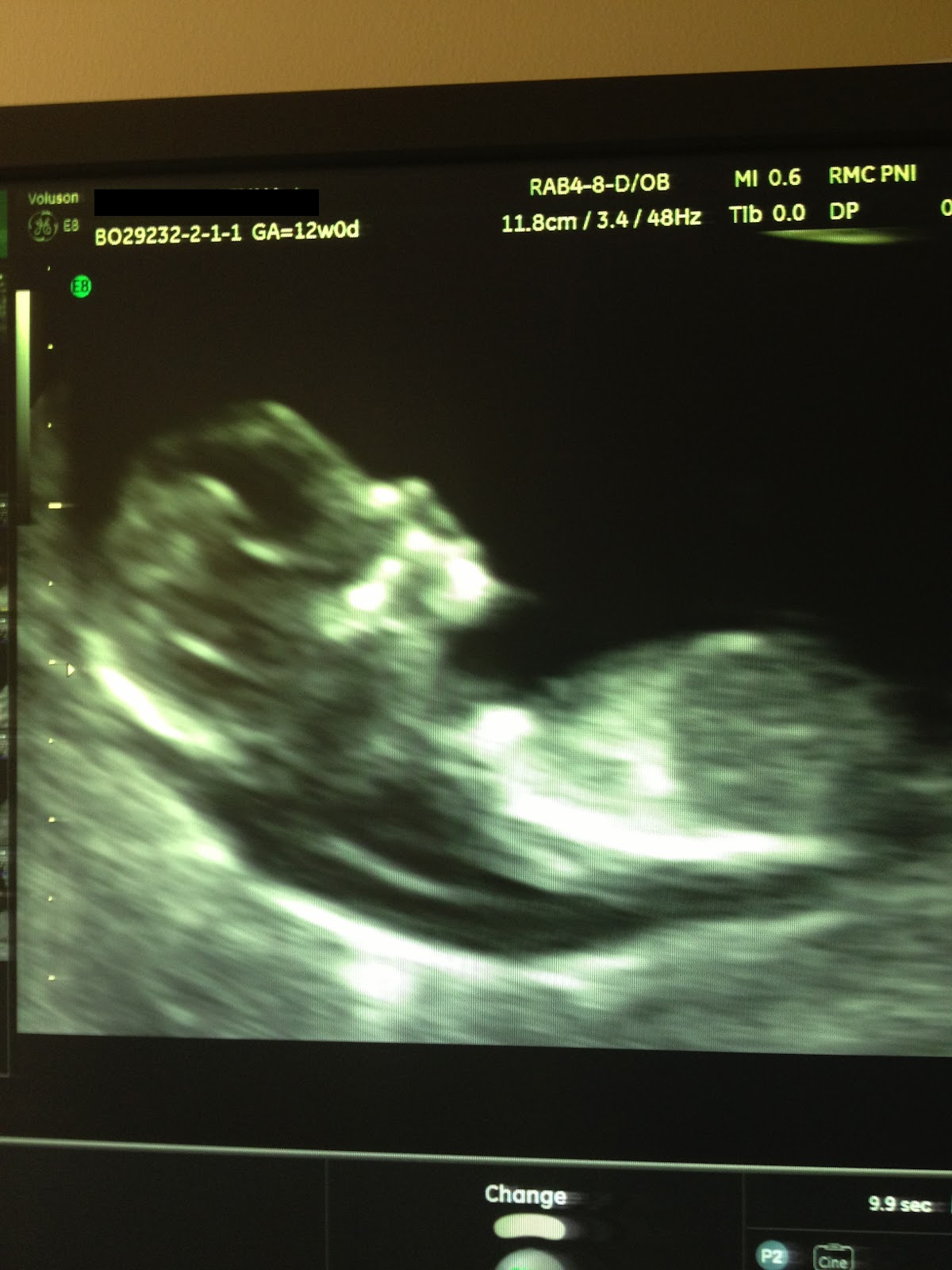 Making Smudge a Sister