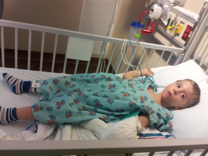 Spastic Quadriplegic Cerebral Palsy: Nissen Fundoplication