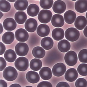The Domestic Yogi: Live Blood Cell Analysis Shines Spotlight on My Health
