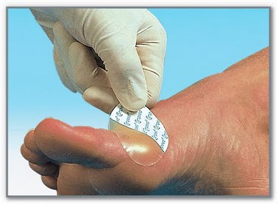 Annie's Simple Life: All About Compeed