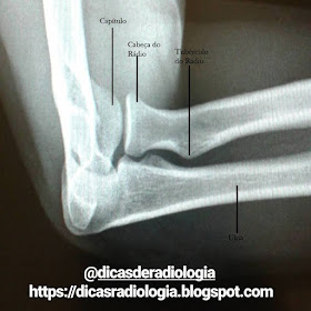 DICAS DE RADIOLOGIA - Tudo Sobre Radiologia: RX DE COTOVELO - MÉTODO DE ...