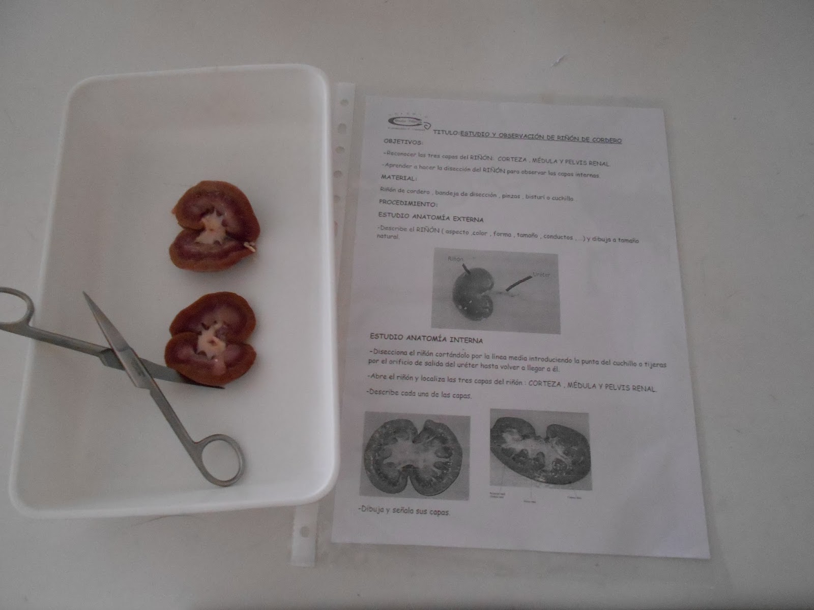 CIENCIABF: DISECCIÓN DEL RIÑÓN