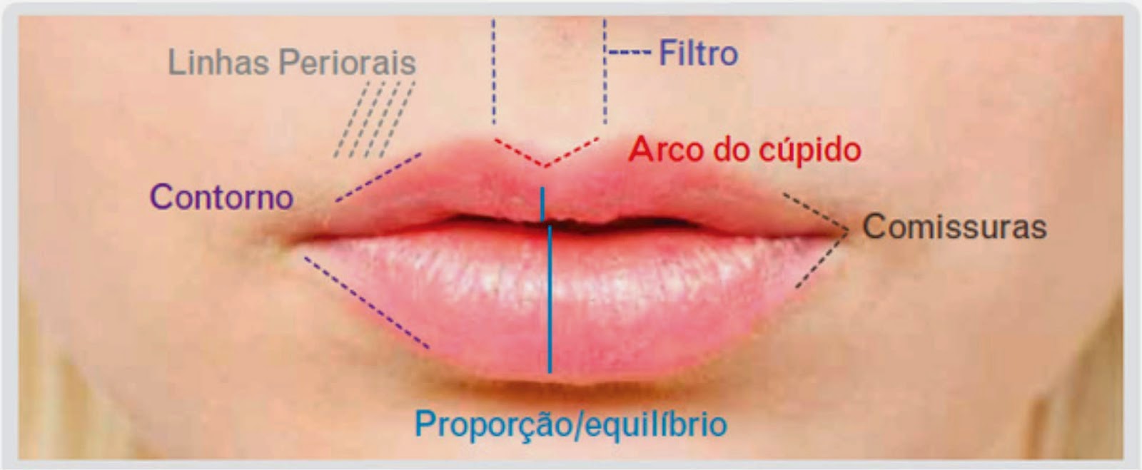 Tuberculo Do Labio Superior - RETOEDU