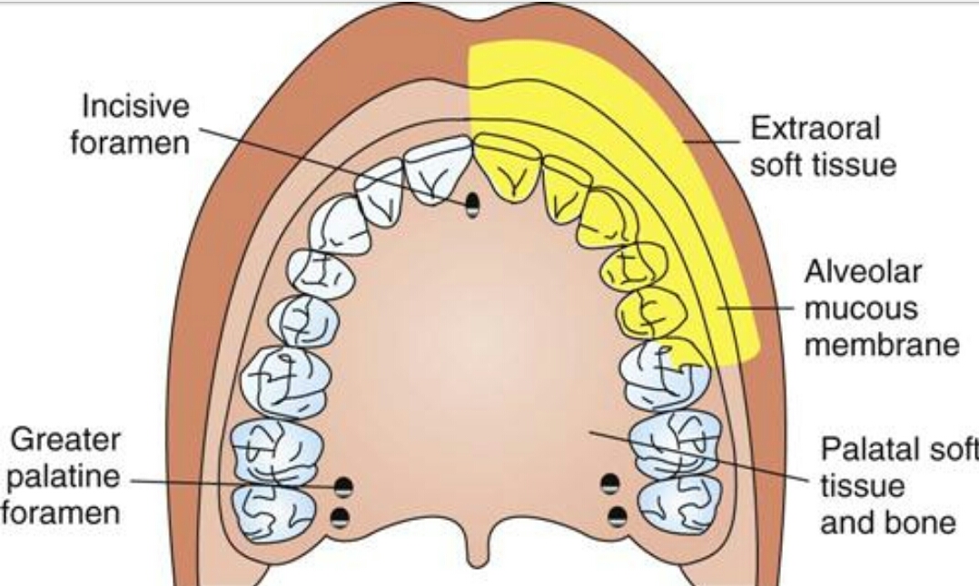 INFRAORBITAL NERVE BLOCK infraorbital-nerve-block