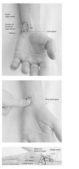 Acupuncture: HT - 5 (HEART - 5)